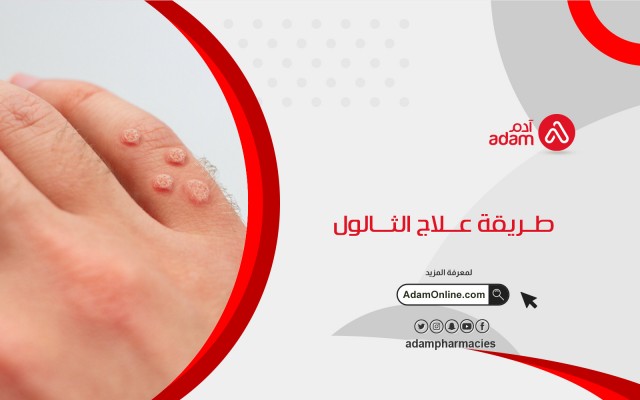 صيدلية ادم اونلاين | علاج الثالول