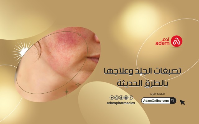 Adam Pharmacies | Skin pigmentation and its treatment by modern methods