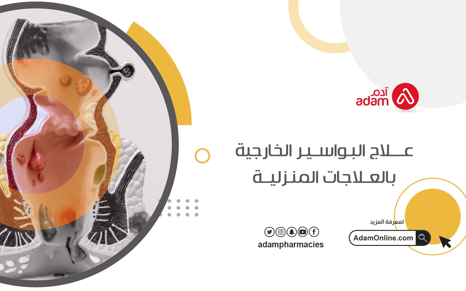 Adam Pharmacies | Treatment of external hemorrhoids with home remedies